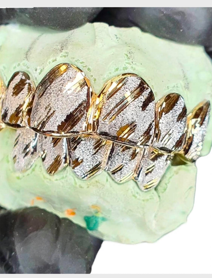 Grillzstation | Diamond Grillz for Teeth | Custom Gold Grillz