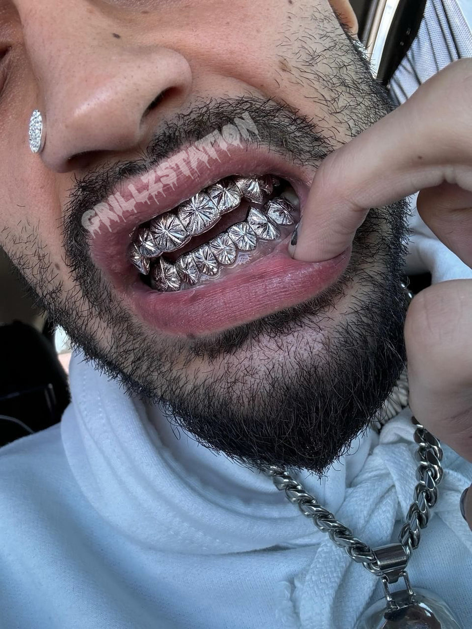 Grillzstation | Diamond Grillz for Teeth | Custom Gold Grillz
