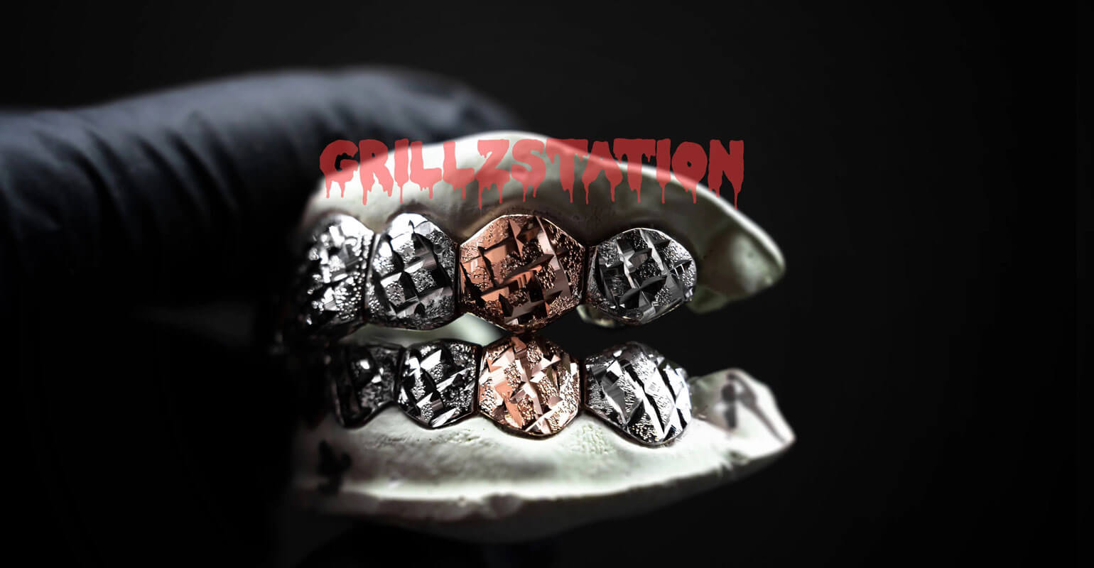 Grillzstation | Diamond Grillz for Teeth | Custom Gold Grillz