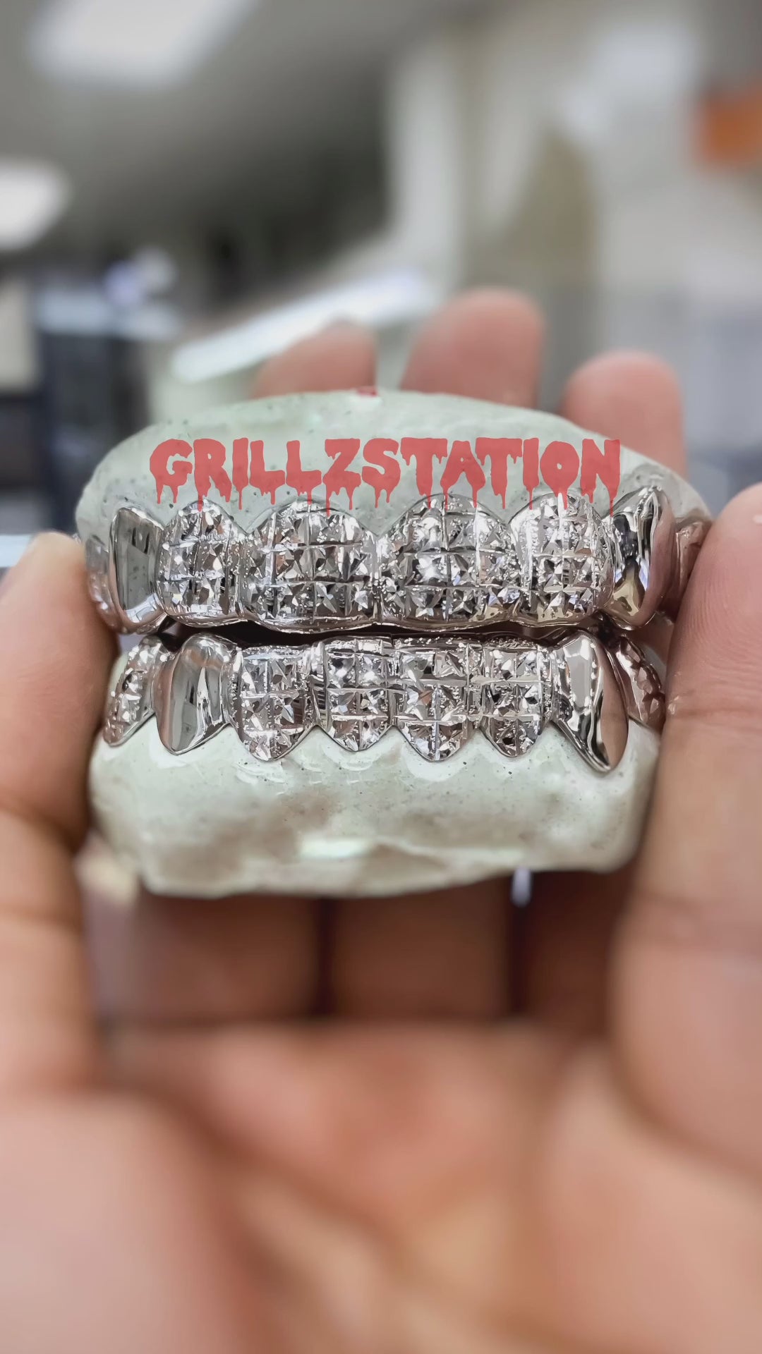 Grillzstation | Diamond Grillz for Teeth | Custom Gold Grillz
